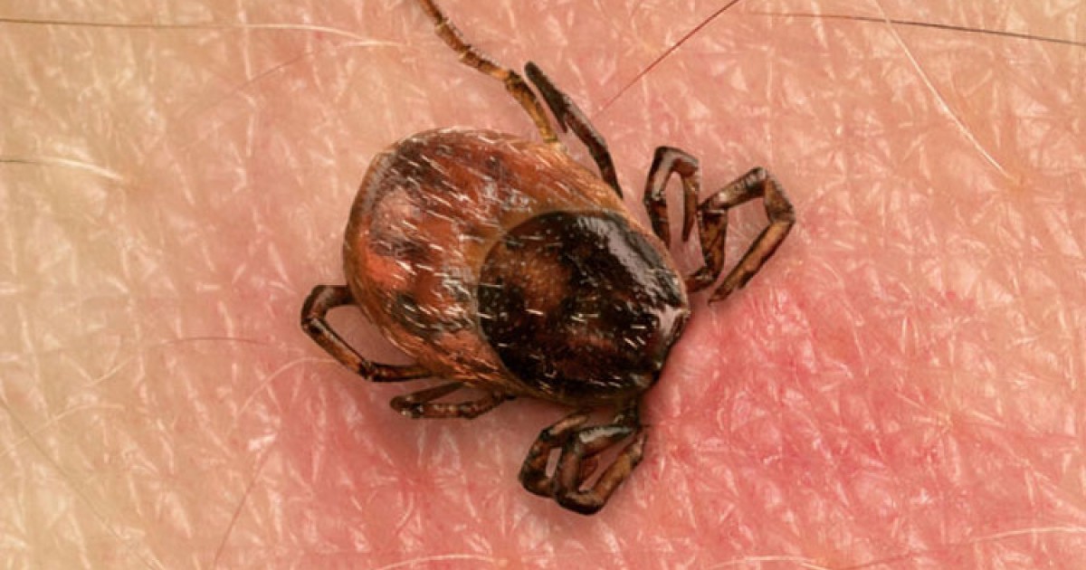 Ujed krpelja je potencijalno opasan | (Vesti - 25. 05. 2022) Subotica.com