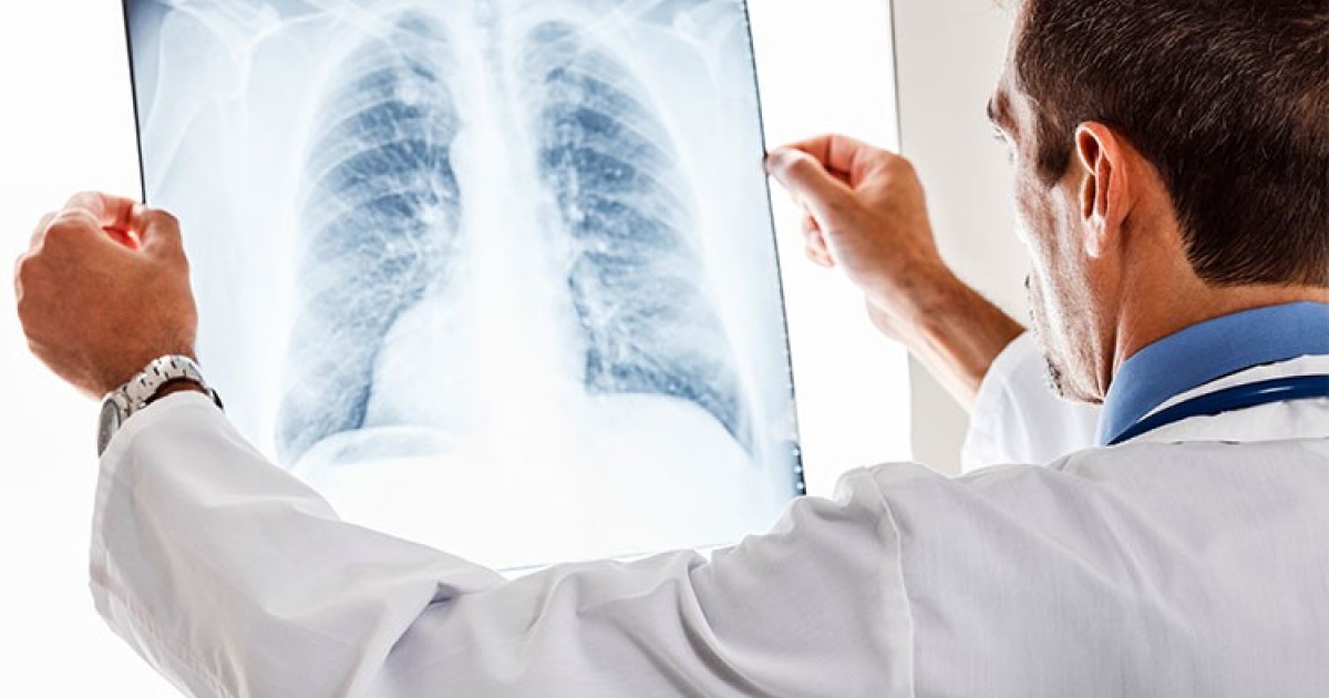 Tuberkulozu i plućne bolesti je moguće sprečiti | (Vesti - 22. 09. 2020 ...